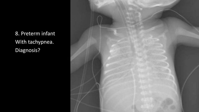 Radiology - Practical Exam for Basic Pediatric and GIT imaging.pptx