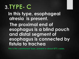 Tracheoesophageal Fistula || TEF || Esophageal fistula | PDF