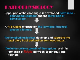 Tracheoesophageal Fistula || TEF || Esophageal fistula | PDF