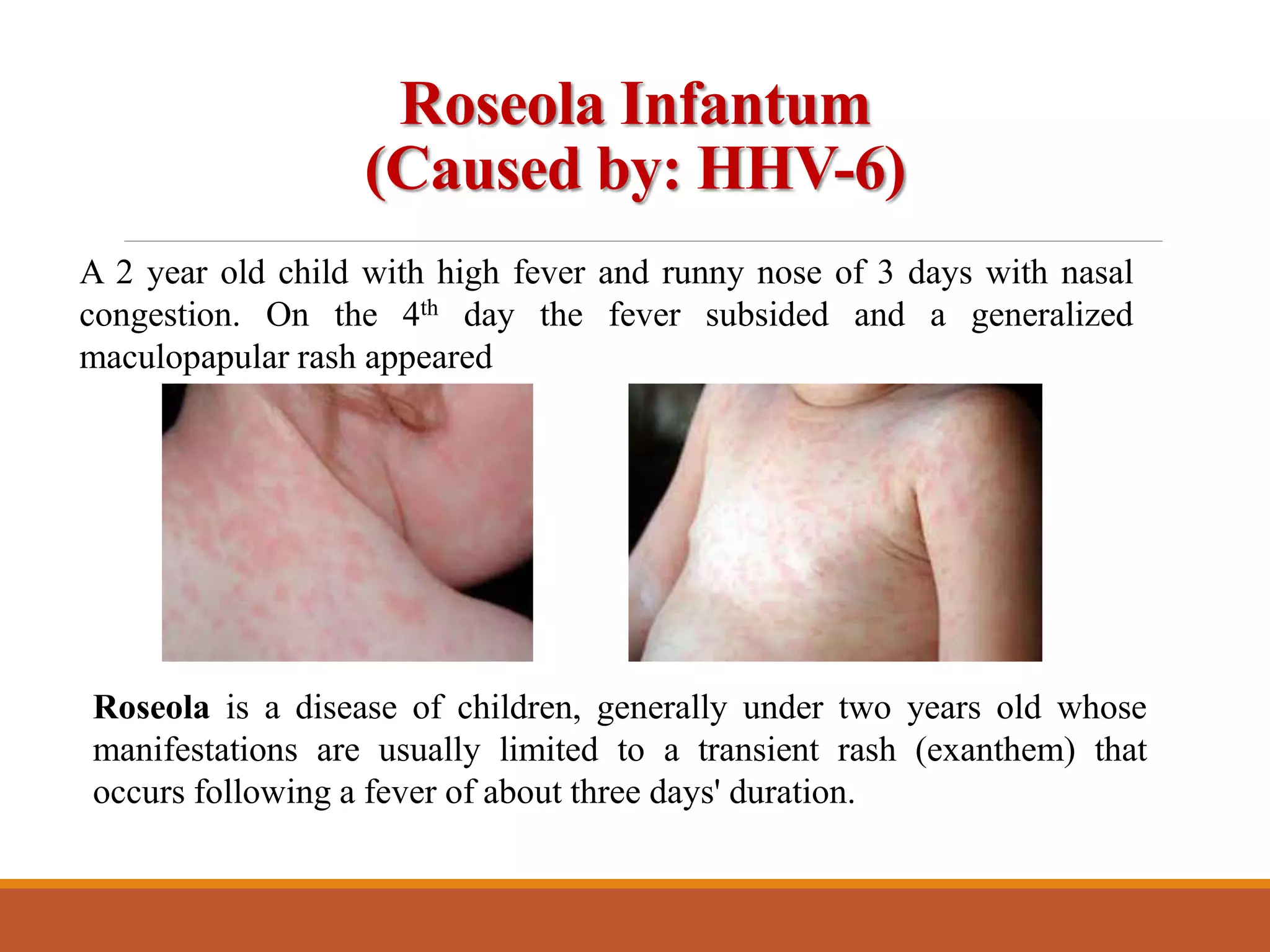 Pediatrics OSCE pictures | PPTX