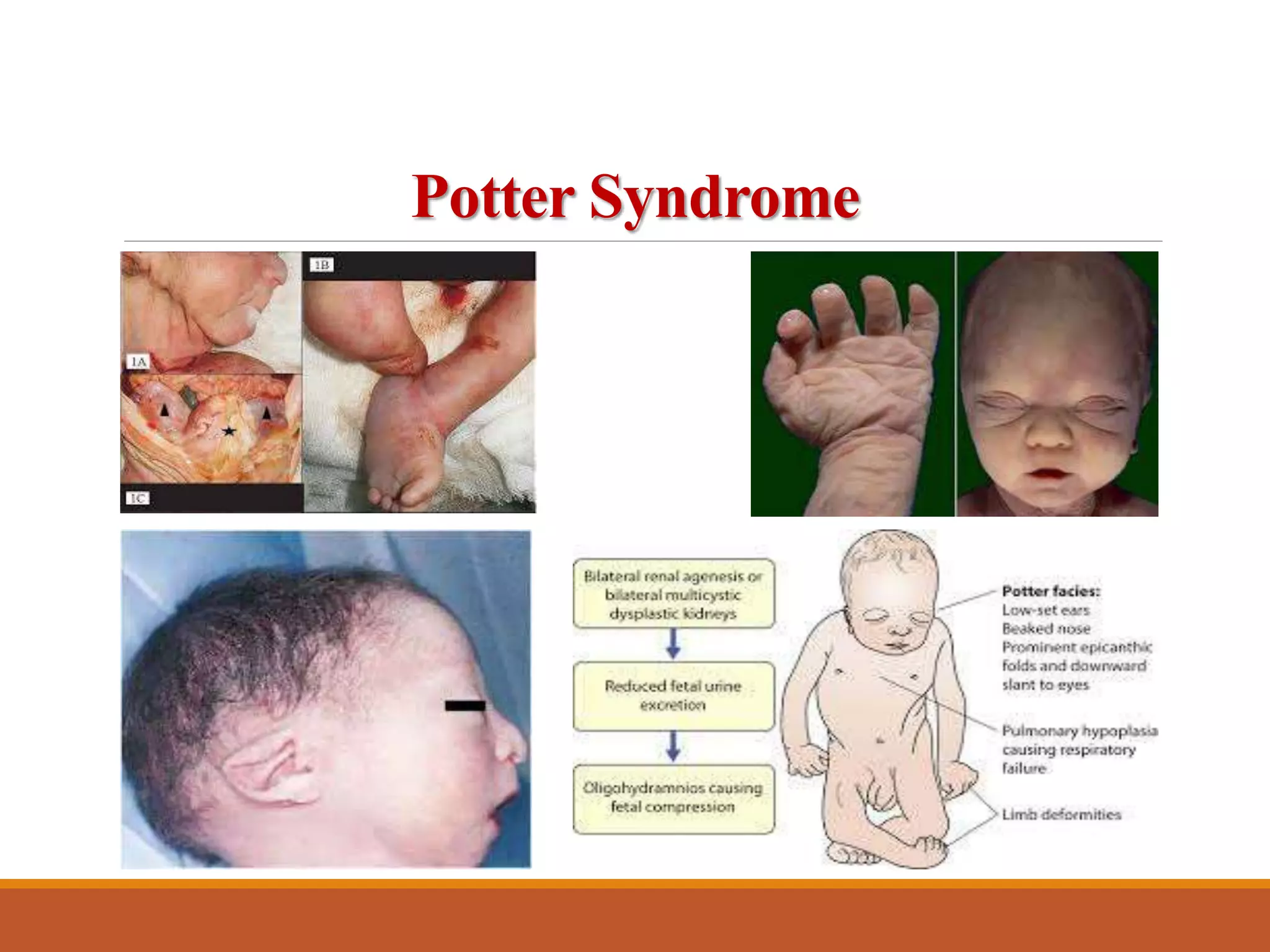 Pediatrics OSCE pictures part 2 | PPTX
