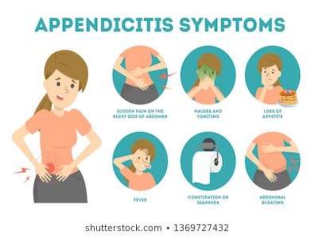 Pedi appendicitis | PPT
