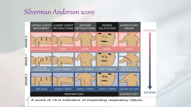 Nursing management of Preterm, Term, Post-term and IUGR Baby.pptx