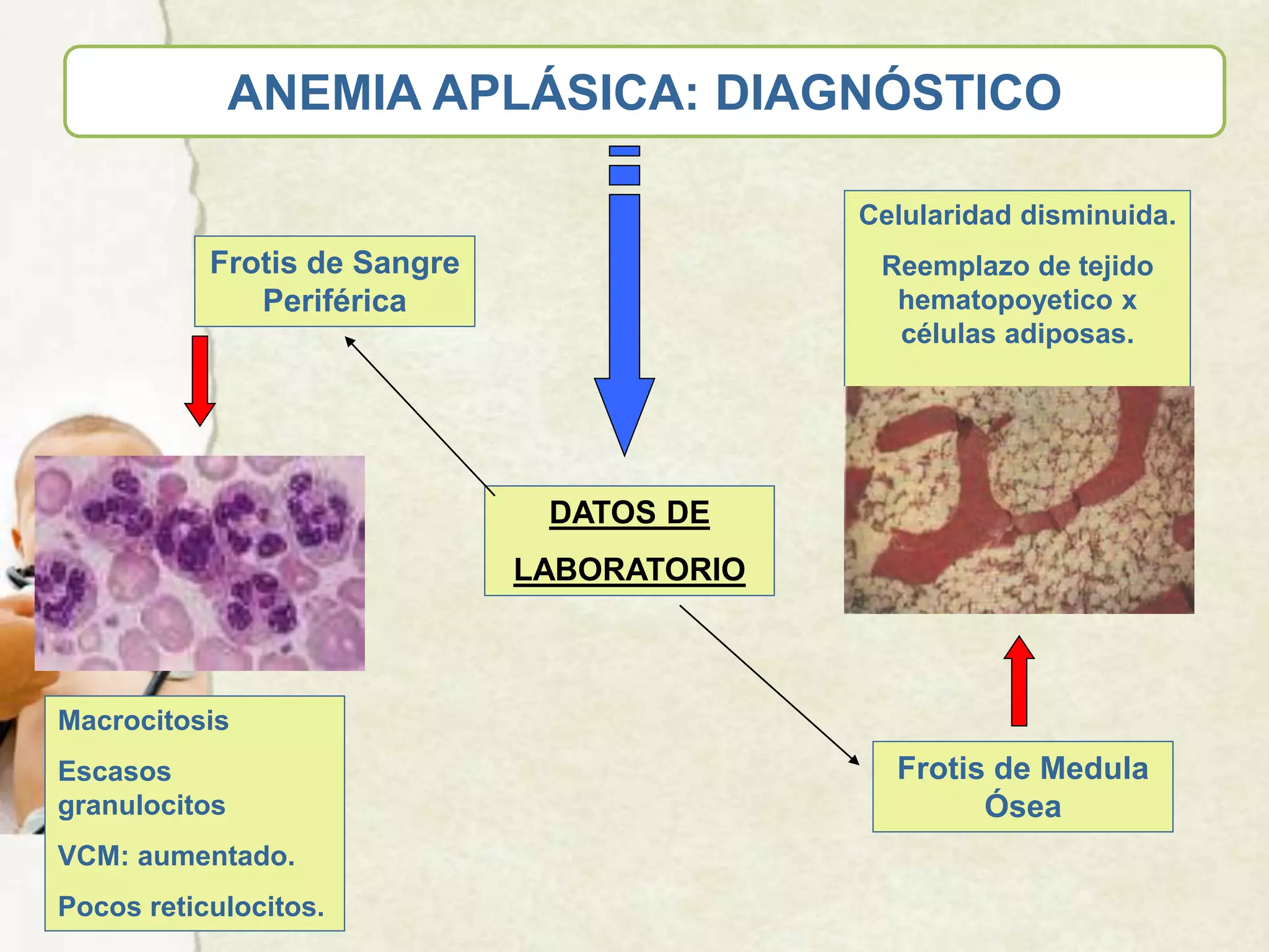 CLASIFICACION FISIOPATOLOGICA DE LAS ANEMIAS | PPTX
