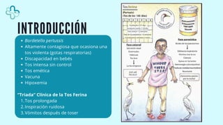 Tos Ferina en Pacientes Pediátricos .pdf