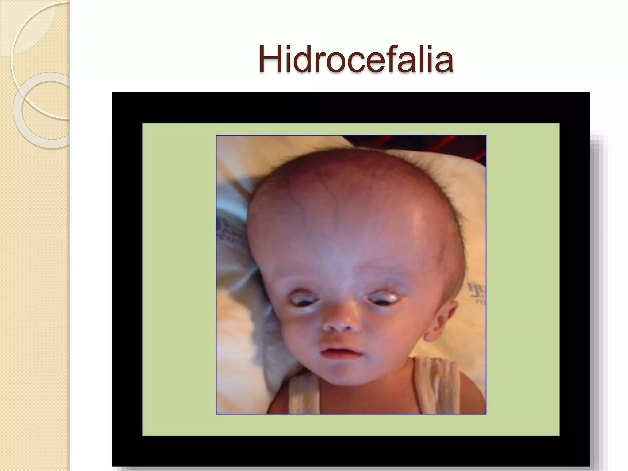 enfermedades quirurgicas mas comunes en pediatria | PPTX