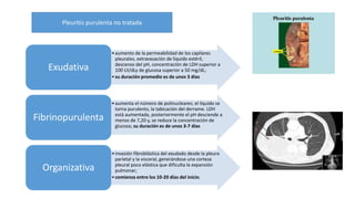 pediatria Derrame pleural.pptx