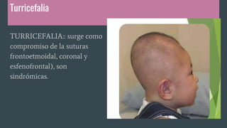 Pediatría examen físico examen semiología deformidades congenitas.pptx
