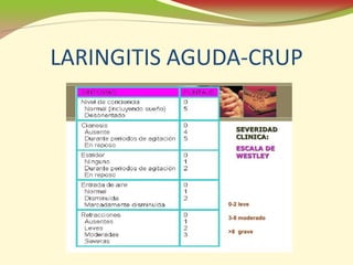 Pediatría laringitis | PPTX