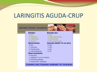 Pediatría laringitis | PPTX