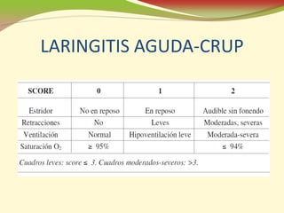 Pediatría laringitis | PPTX