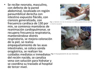 Pediatria_malformaciones_del_abdomen.pdf