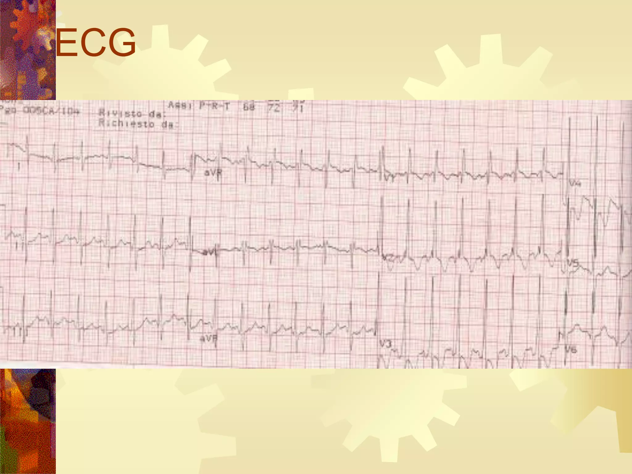 Pediatric cardiac-anomalies-part-3 | PPT