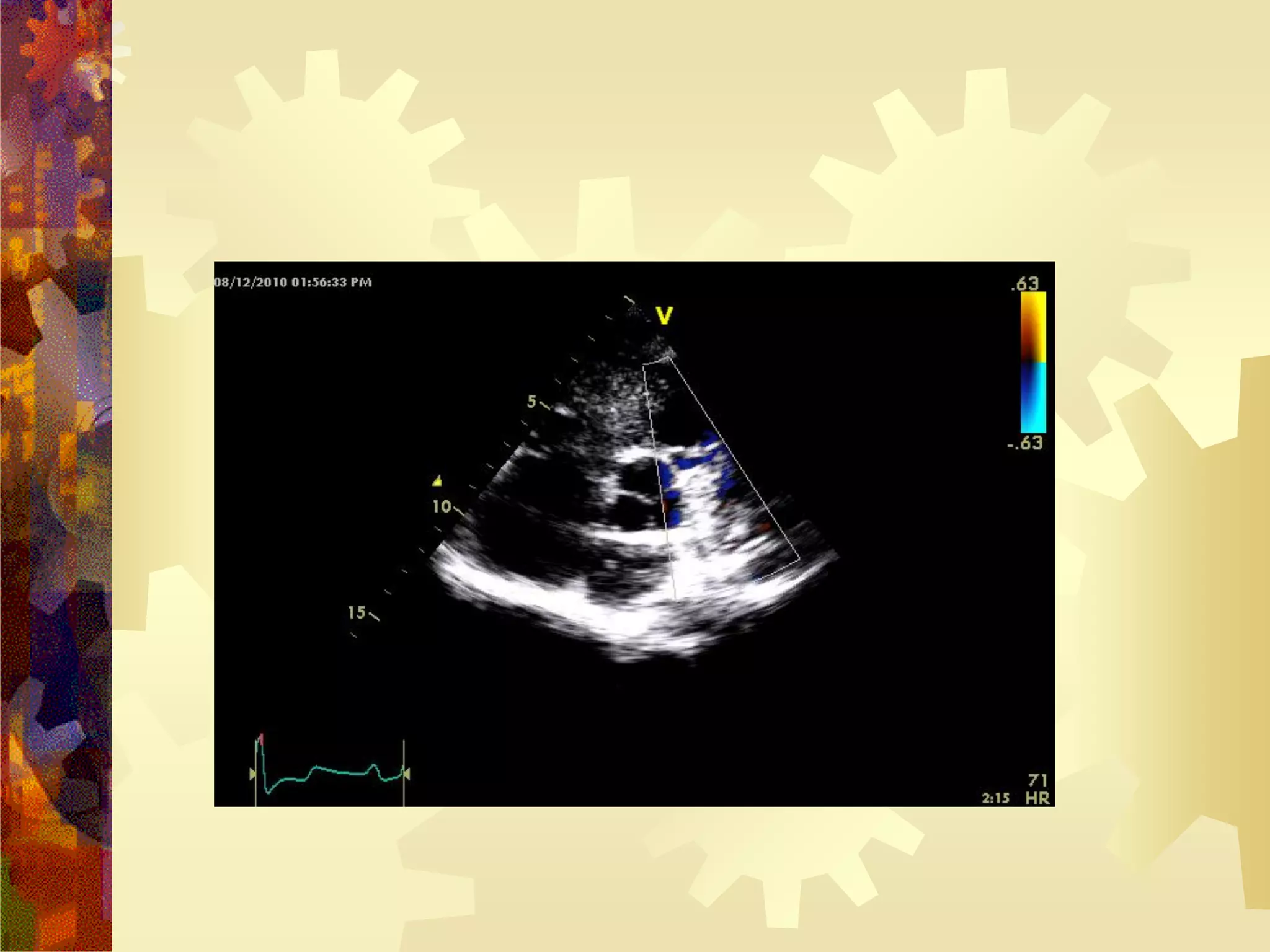 Pediatric cardiac-anomalies-part-3 | PPT