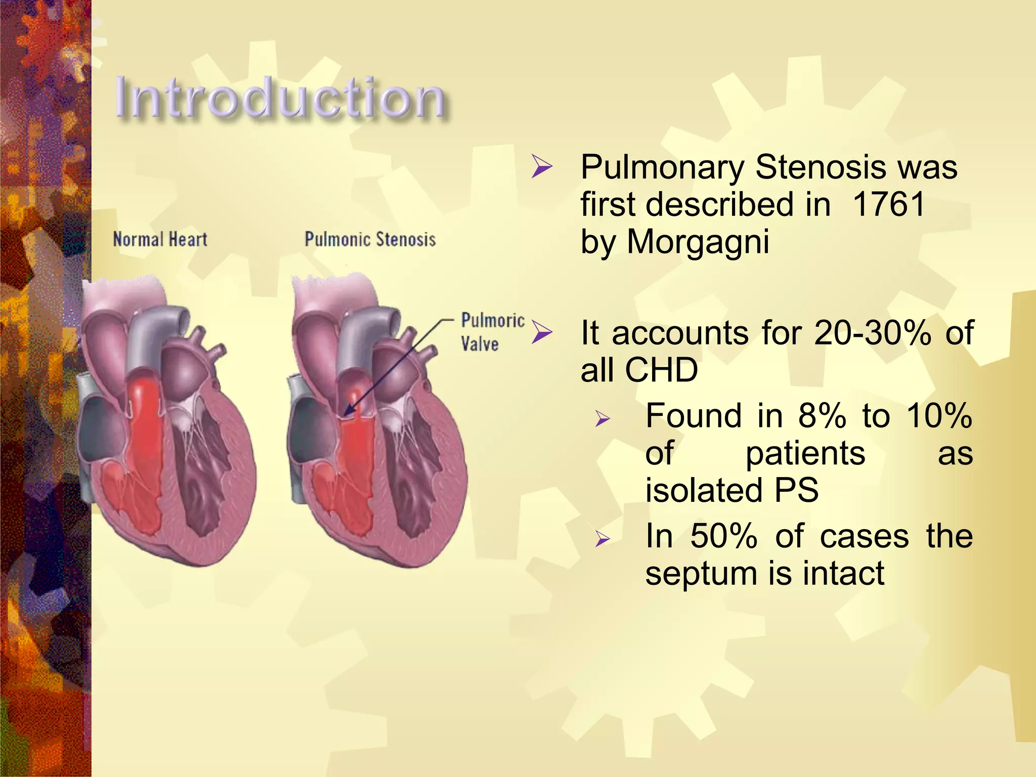 Pediatric cardiac-anomalies-part-3 | PPT