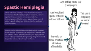 Pediatric Cerebral Palsy: A Comprehensive Overview.pptx