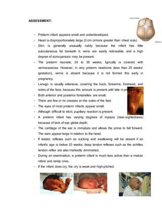 Pediatric disorders | DOCX