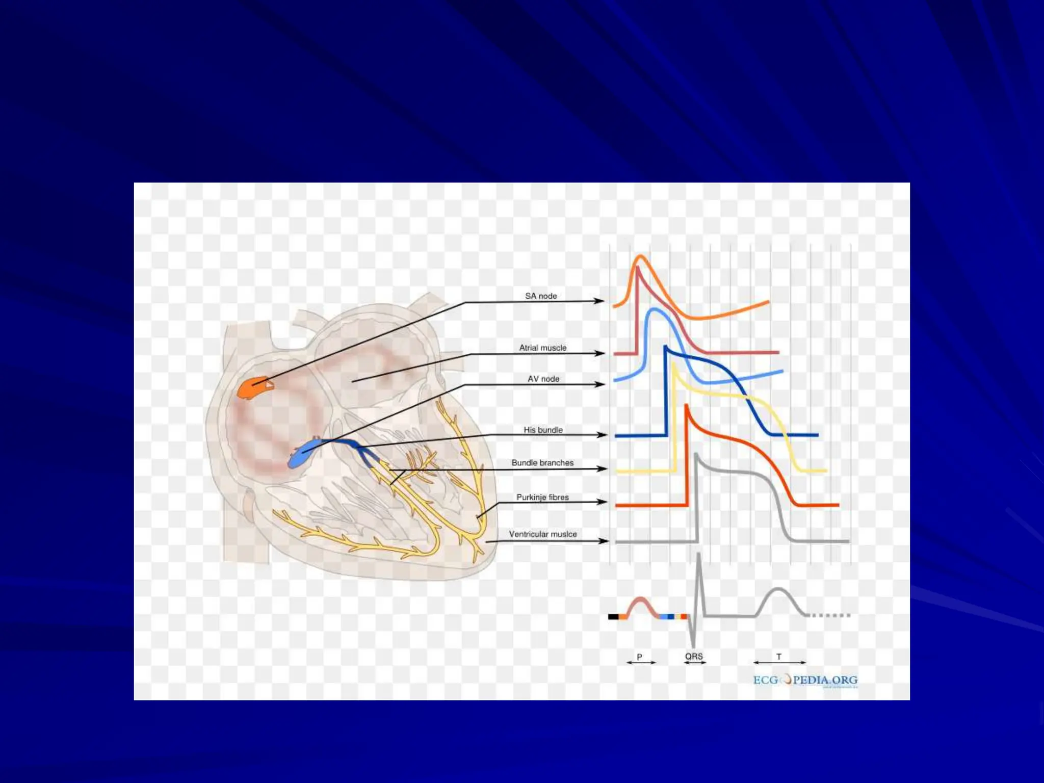 Pediatric-EKG-Interpretation-2018.ppt