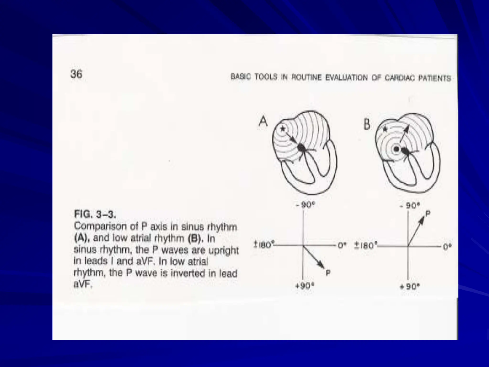 Pediatric-EKG-Interpretation-2018.ppt
