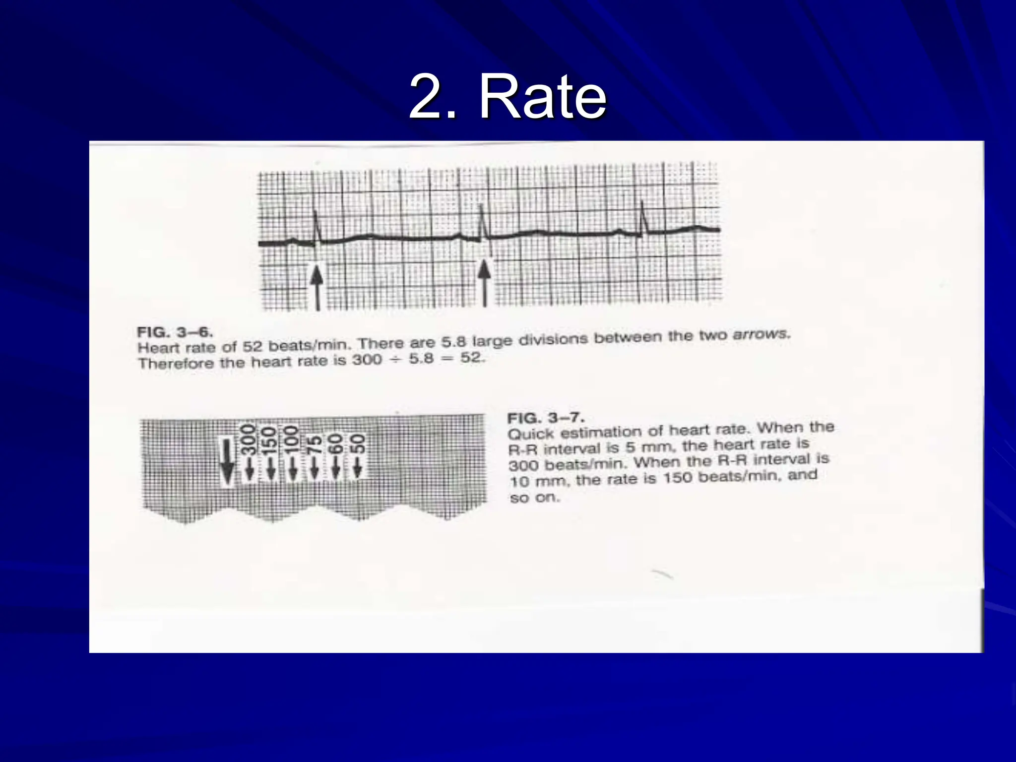 Pediatric-EKG-Interpretation-2018.ppt