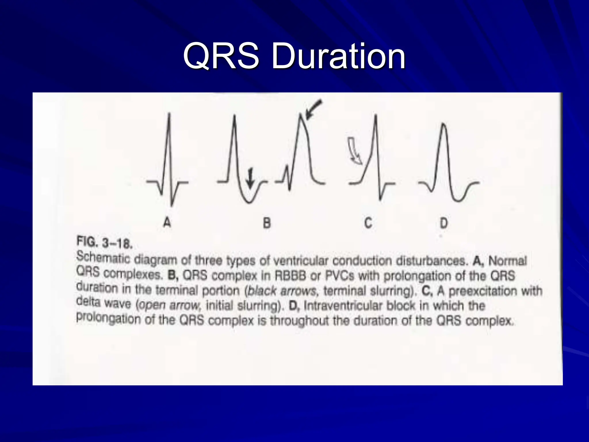 Pediatric-EKG-Interpretation-2018.ppt