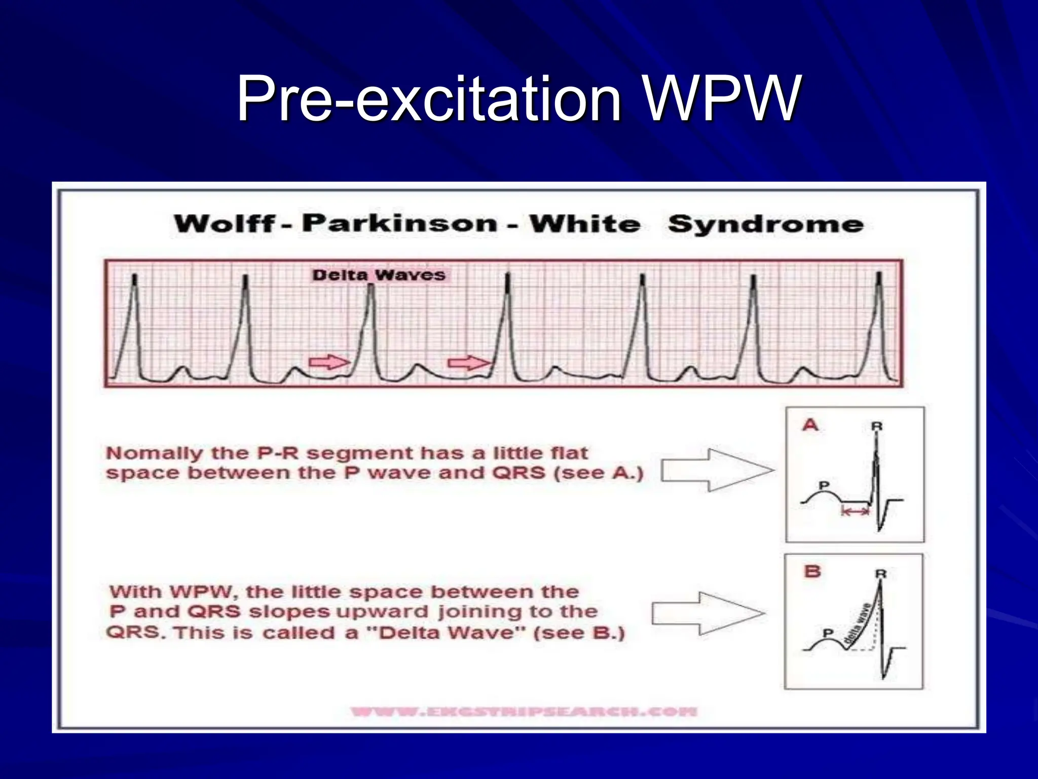 Pediatric-EKG-Interpretation-2018.ppt