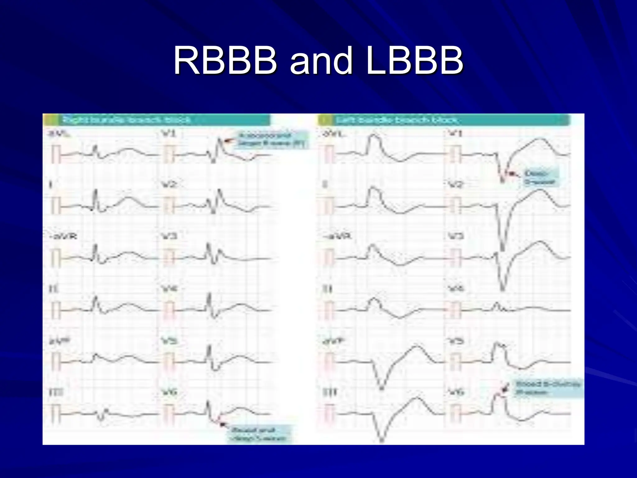Pediatric-EKG-Interpretation-2018.ppt