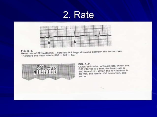 Pediatric-EKG-Interpretation-2018.ppt