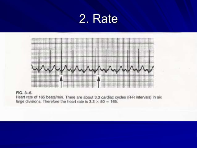 Pediatric-EKG-Interpretation-2018.ppt