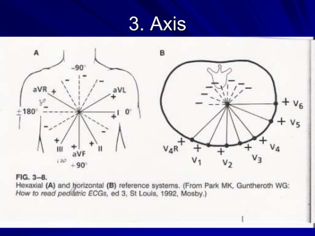 Pediatric-EKG-Interpretation-2018.ppt