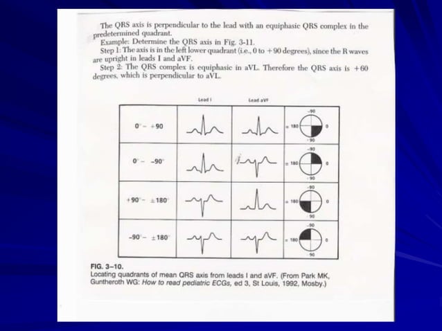 Pediatric-EKG-Interpretation-2018.ppt