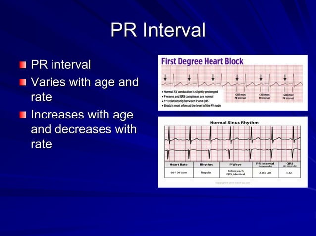 Pediatric-EKG-Interpretation-2018.ppt