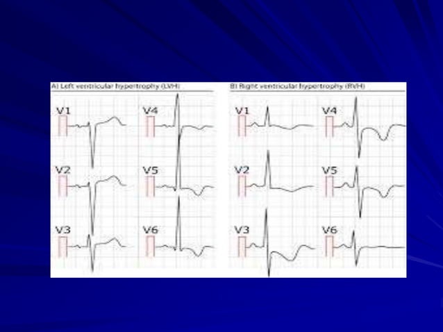 Pediatric-EKG-Interpretation-2018.ppt