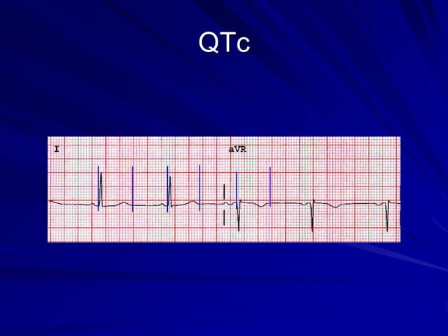Pediatric-EKG-Interpretation-2018.ppt