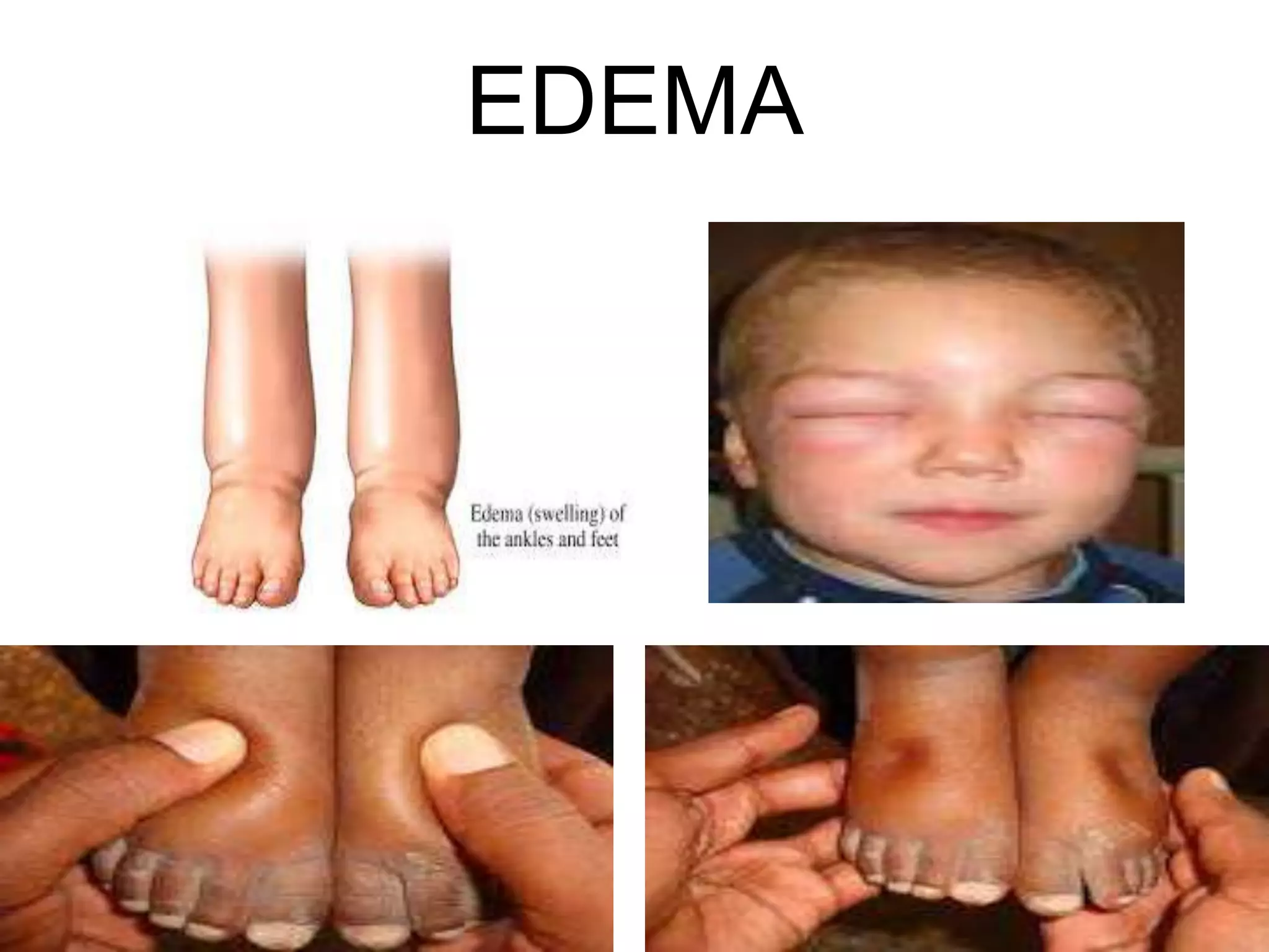 Pediatric physical assessment in children | PPTX