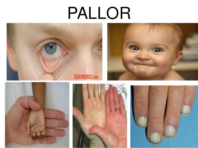 Pediatric physical assessment in children