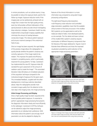 Special Report: Challenges and Solutions in Pediatric X-ray | PDF