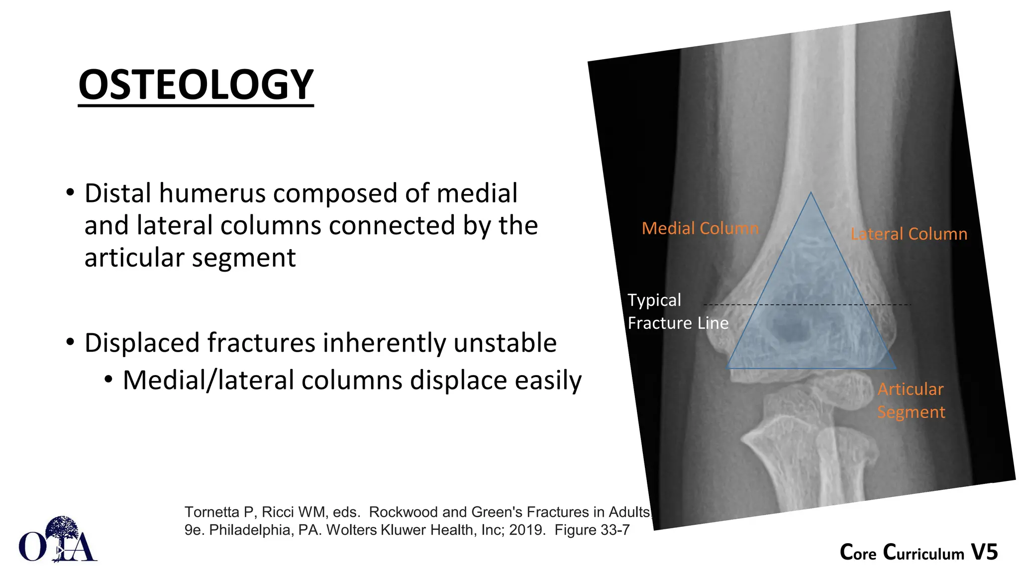 Pediatric2 Supracondylar Humerus Fractures.pdf