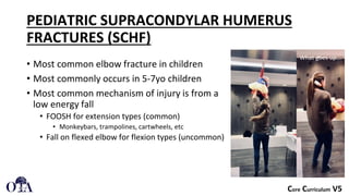 Pediatric2 Supracondylar Humerus Fractures.pdf
