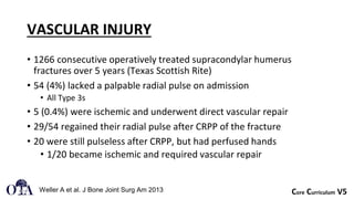 Pediatric2 Supracondylar Humerus Fractures.pdf