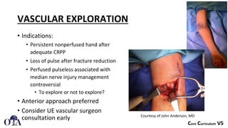 Pediatric2 Supracondylar Humerus Fractures.pdf