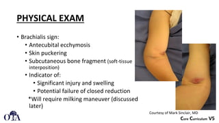 Pediatric2 Supracondylar Humerus Fractures.pdf
