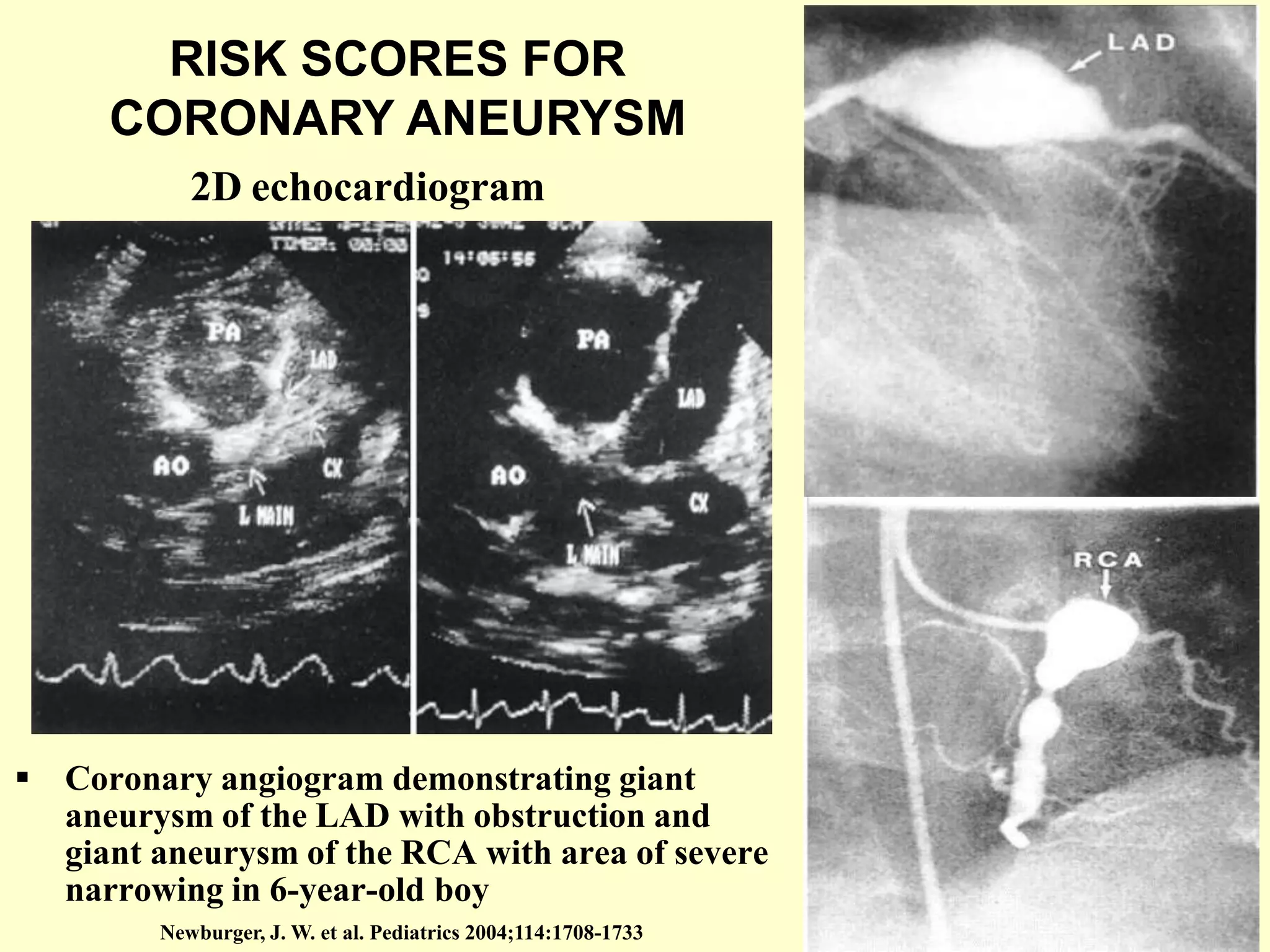 Pediatric Acquired Heart Diseases - Rivin | PPTX