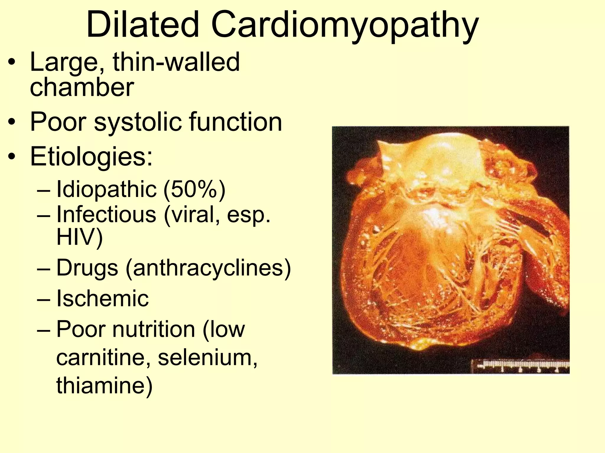 Pediatric Acquired Heart Diseases - Rivin | PPTX