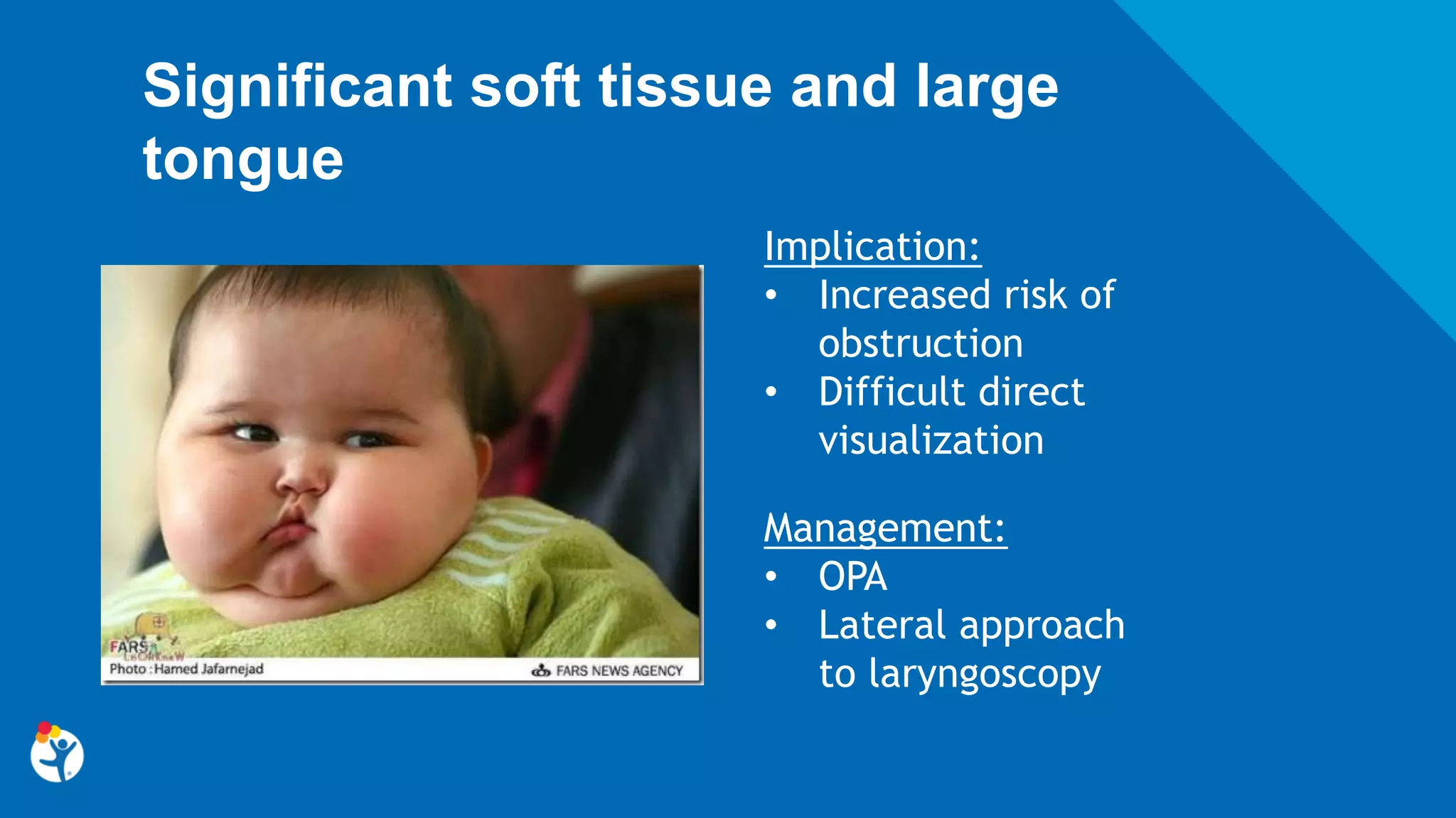 Pediatric Airway Management | PDF | First Aid | Injuries