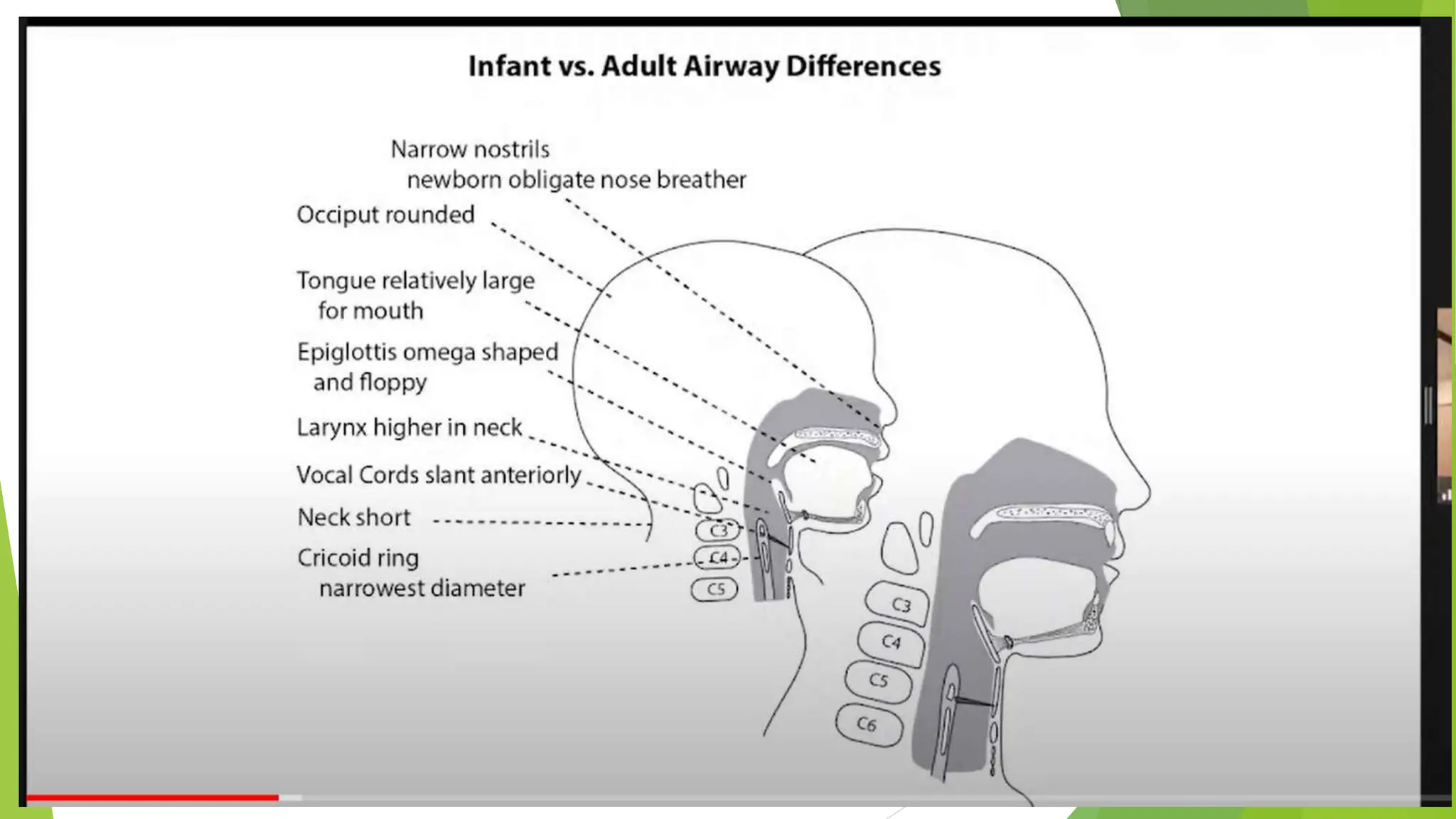 PEDIATRIC AIRWAY comparison between adults | PPTX