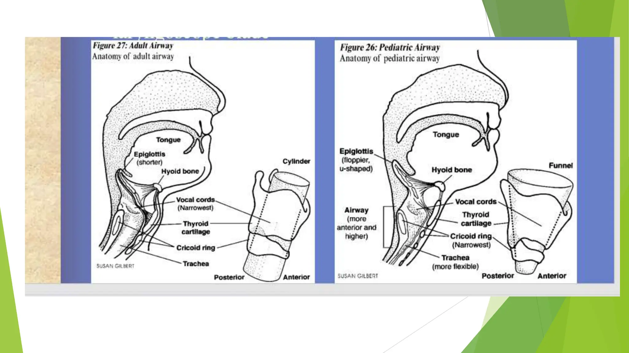 PEDIATRIC AIRWAY comparison between adults | PPTX