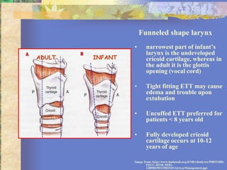 Pediatric Airway Anatomy Physiology and Management.ppt