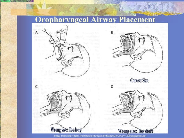 Pediatric Airway Anatomy Physiology and Management.ppt