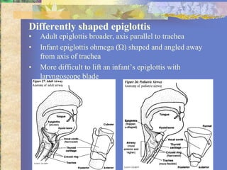Pediatric Airway Anatomy Physiology and Management.ppt
